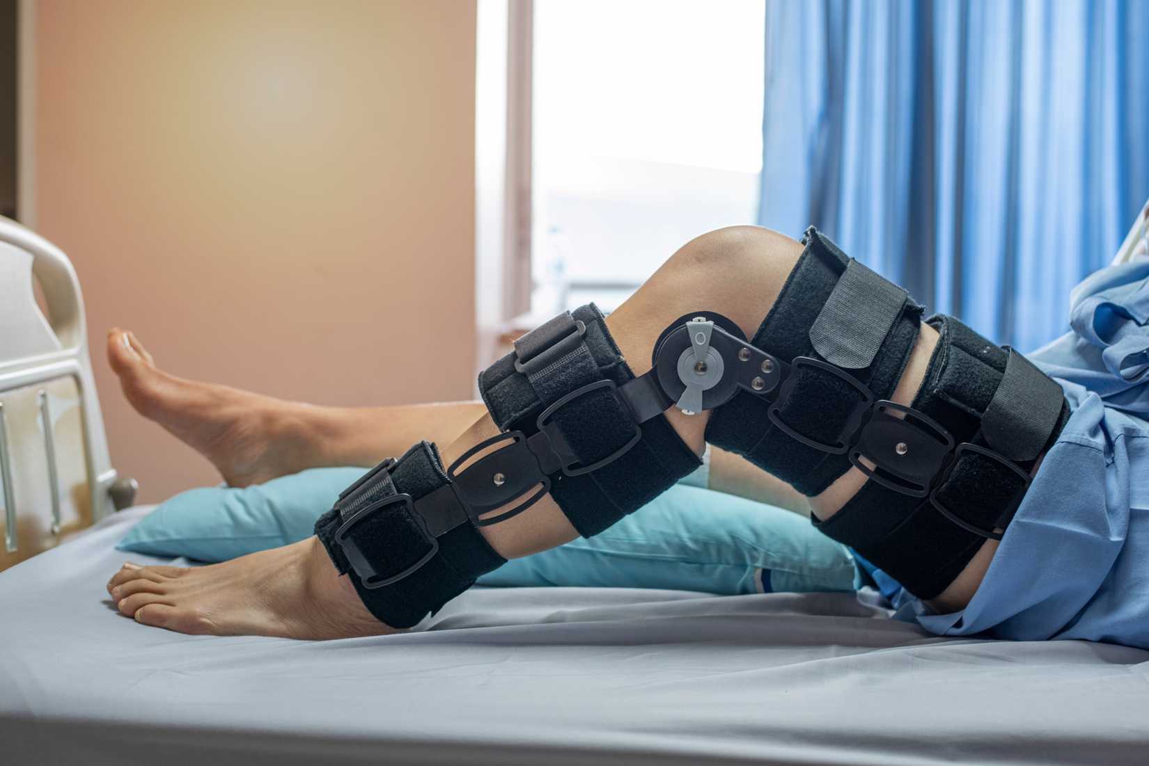Flying With A Leg Brace: What Do You Need To Know?