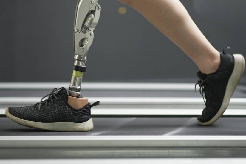 Flying With A Prosthetic Limb: 5 Top Tips